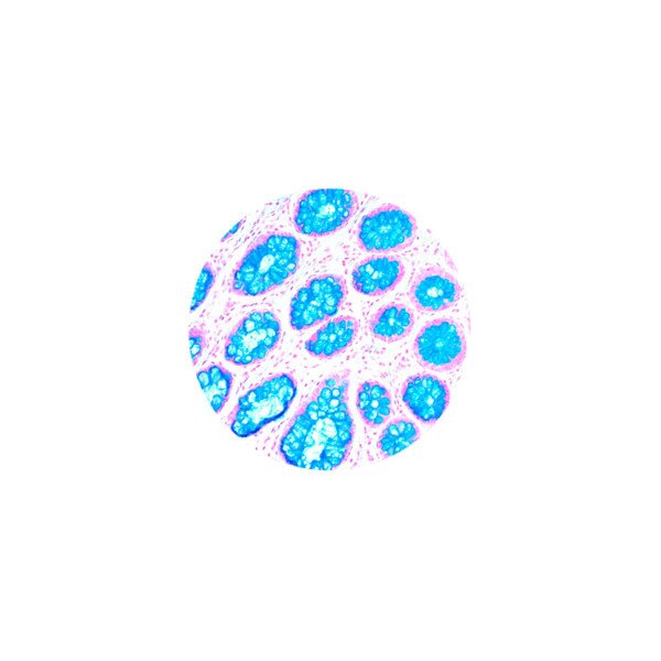 Alcian Blue (pH 2.5) Stain Kit | Azer Scientific Alcian Blue (pH 2.5) Stain Kit | Azer Scientific